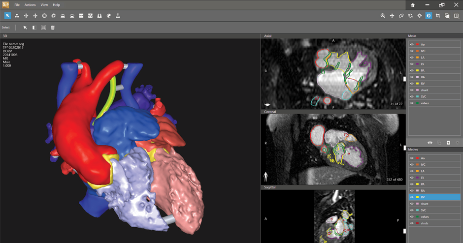 Anatomic Model Solutions | 3D Systems