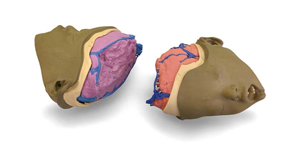 Anatomic Model Solutions | 3D Systems