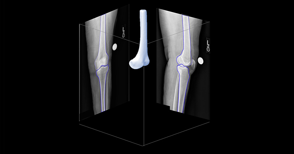 VSP Connect Planning Portal | 3D Systems
