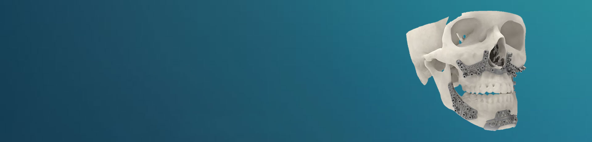 VSP Connect Planning Portal | 3D Systems