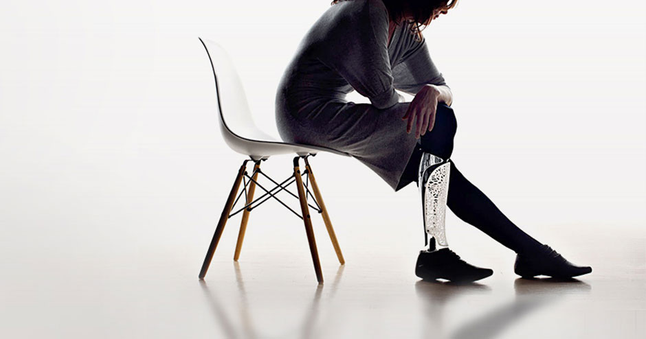 Orthotics and Prosthetics | 3D Systems