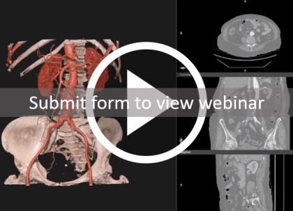DICOM to Print with Virtual Reality | 3D Systems