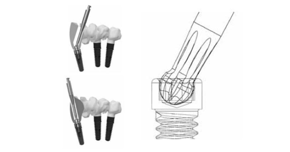 Dental Manufacturing and Design Services | 3D Systems