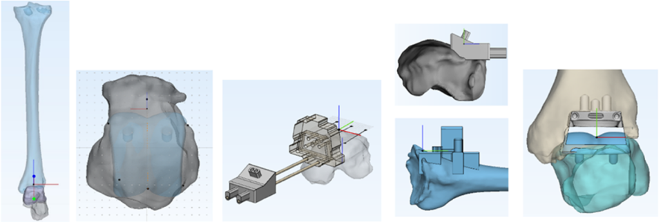 How Ruijin Orthopaedic Institute Built a Production Workflow for ...