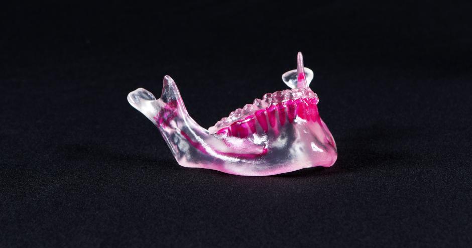 Medical model - 3D Printed Jaw Replica | 3D Systems