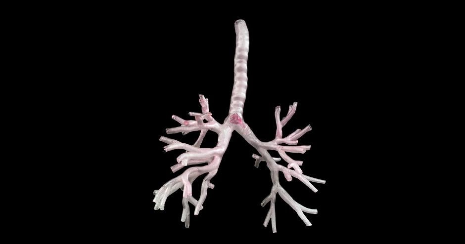 Airway – ProX 800 | 3D Systems
