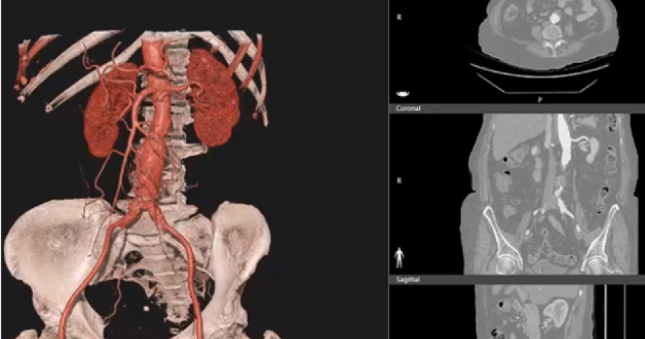 DICOM to Print with Virtual Reality | 3D Systems