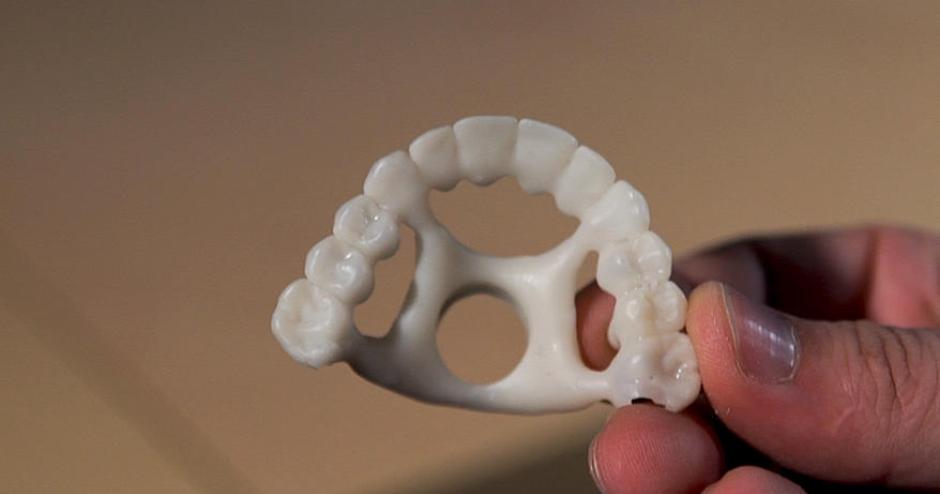 Hybrid Technologies Grows Business with Full-Arch Palatal Jigs 3D ...