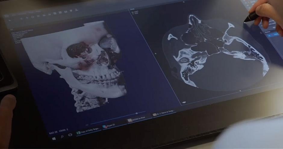 VSP Craniomaxillofacial Solutions | 3D Systems