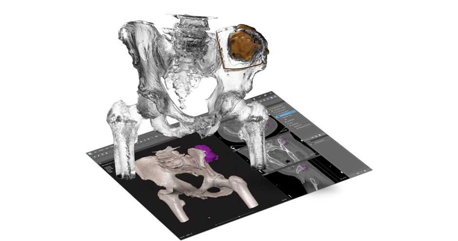 VSP Surgical Planning Solutions | 3D Systems