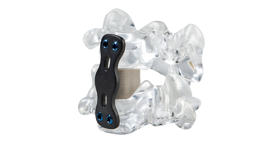 PEEK Material | 3D Systems