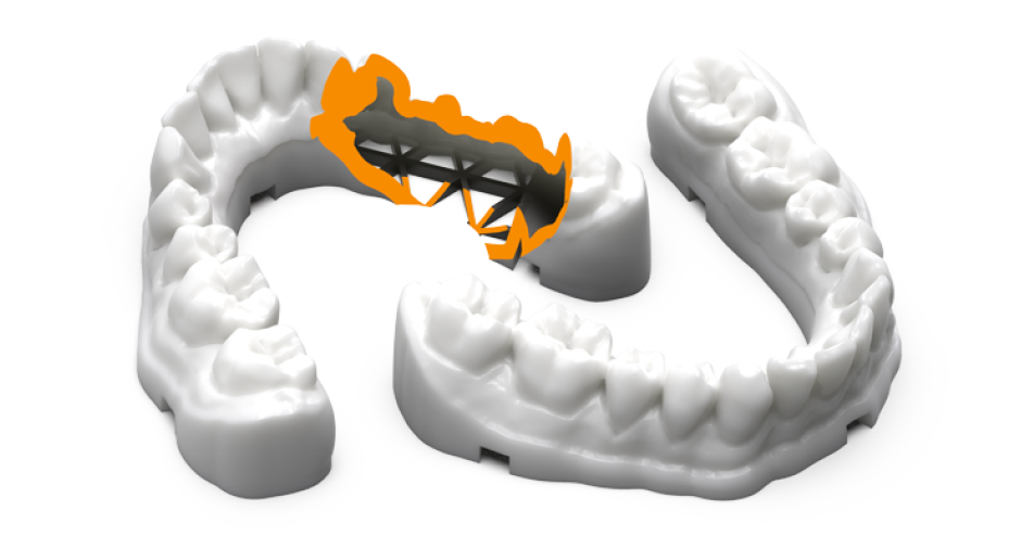 3D Systems Solutions for Clear Aligner Thermoforming Tools | 3D Systems
