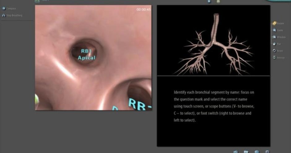 BRONCH Mentor - Essential Bronchoscopy | 3D Systems